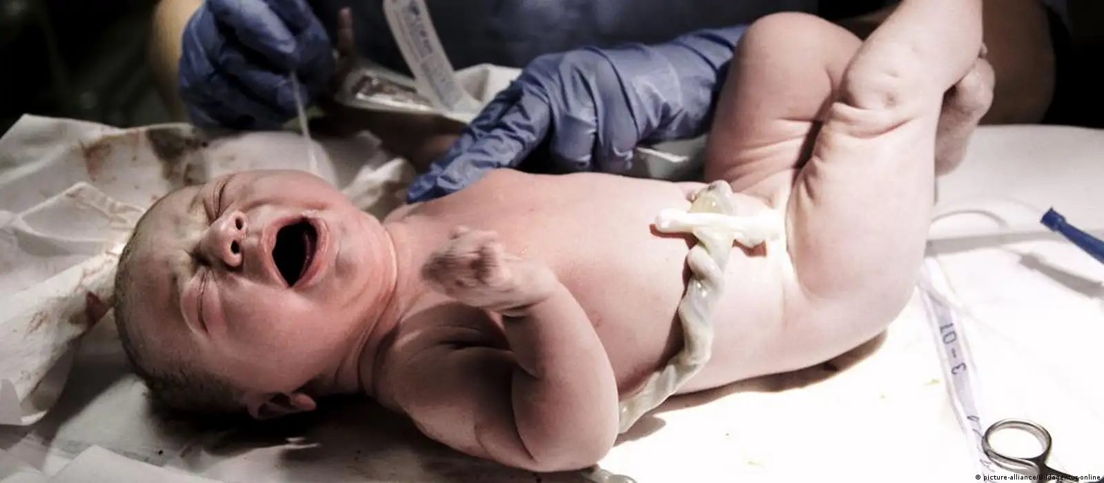 Meth Effects On Babies