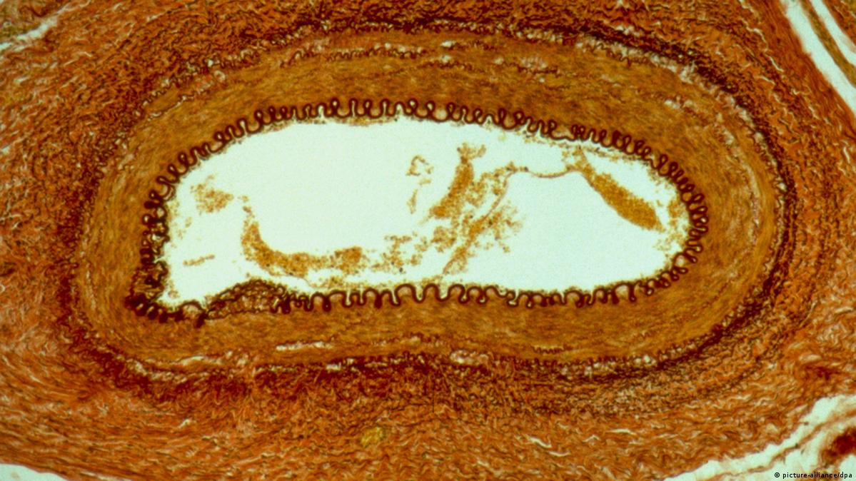 Nanotech in the blood – DW – 06/28/2012