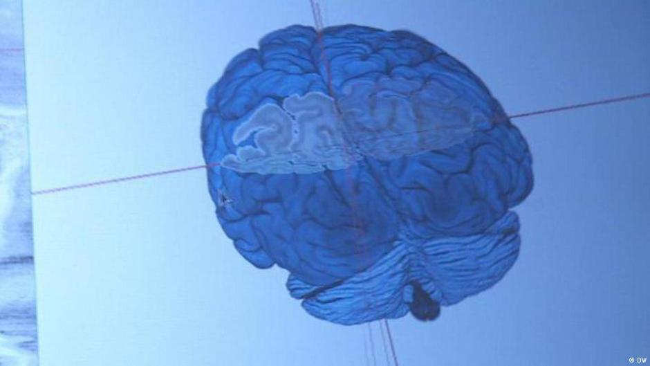 Computers mimicking the human brain – DW – 11/18/2013