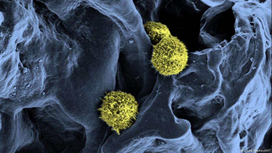 Knochenmark aus dem Labor – DW – 26.01.2014