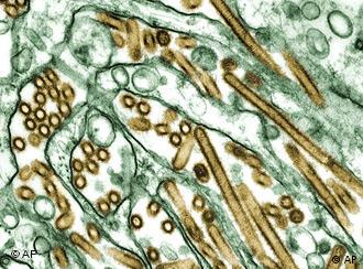 How does an electron microscope work? – DW – 03/02/2012