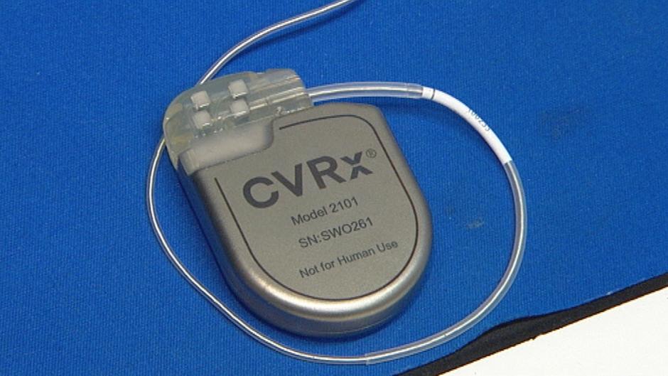 Pacemaker for heart failure – DW – 01/08/2015