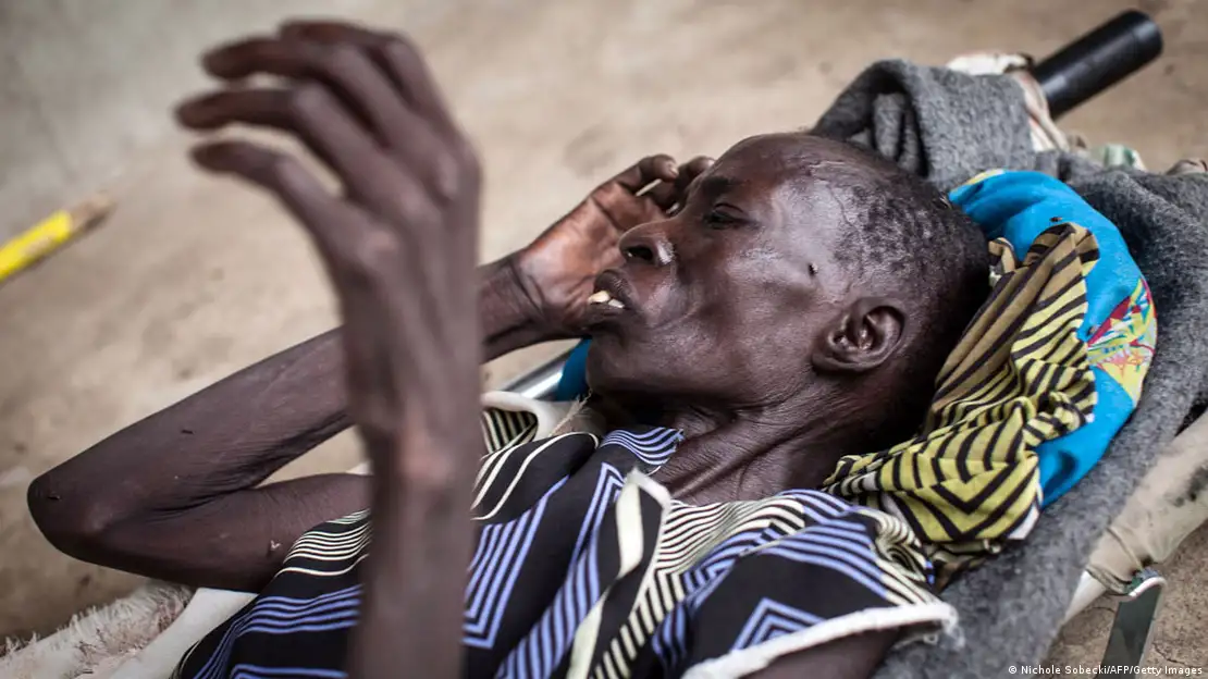 Skinny People In Africa