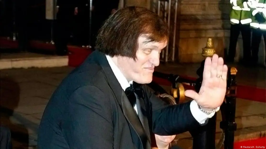 Acromegaly Famous People