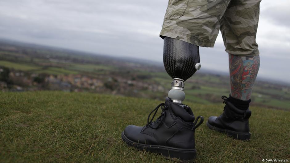 War scars: an ex-soldier's hidden illness – DW – 01/31/2015