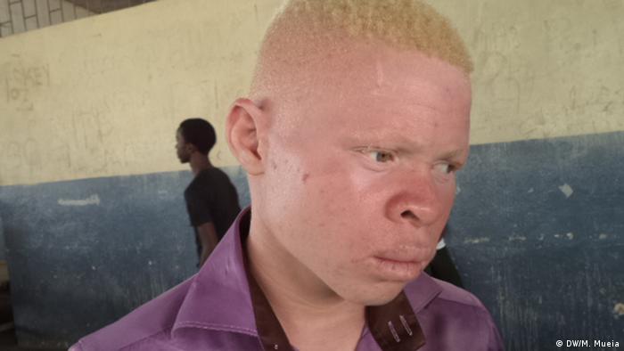 Albinos in Mosambik: Leben in ständiger Gefahr | DW Deutsch Lernen
