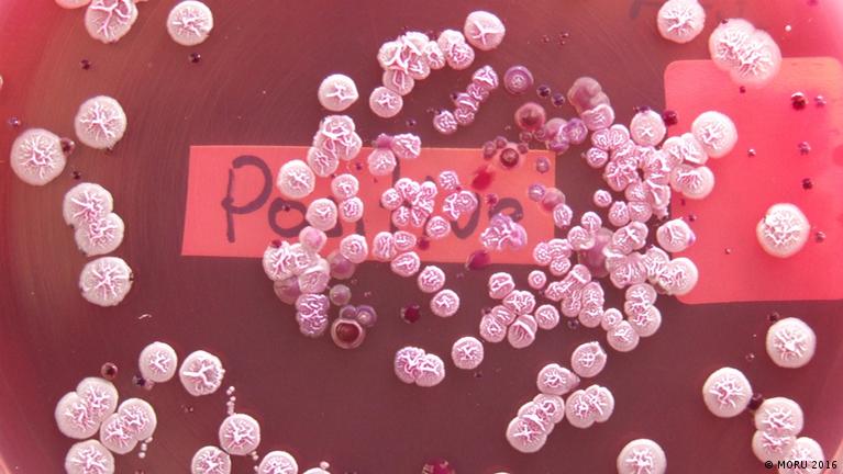 Warnings about a deadly disease – DW – 01/11/2016