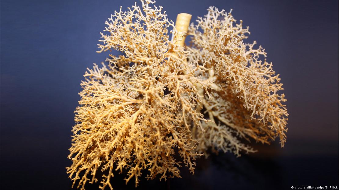 Real Alveoli Mineral Identification Based On Deep Learning Using Image