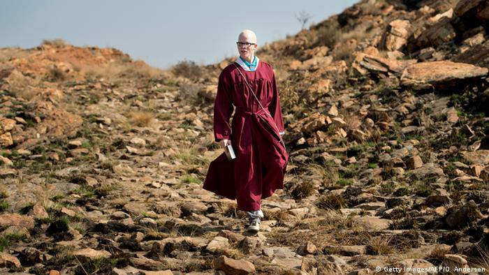 Malawi murder case shines light on anti-albino prejudice in Africa ...