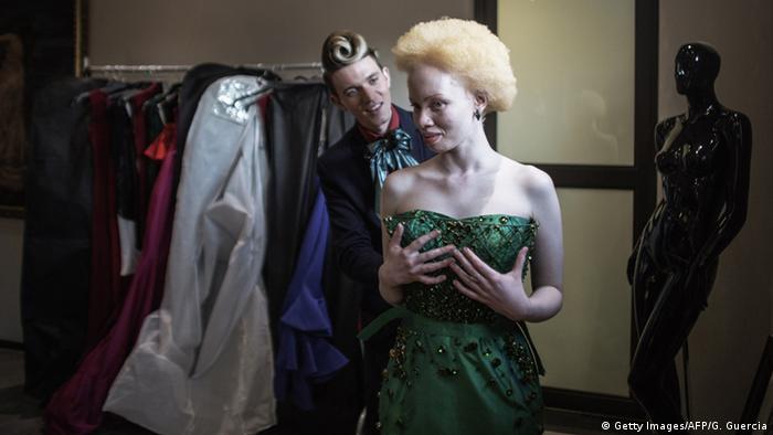 Malawi murder case shines light on anti-albino prejudice in Africa ...