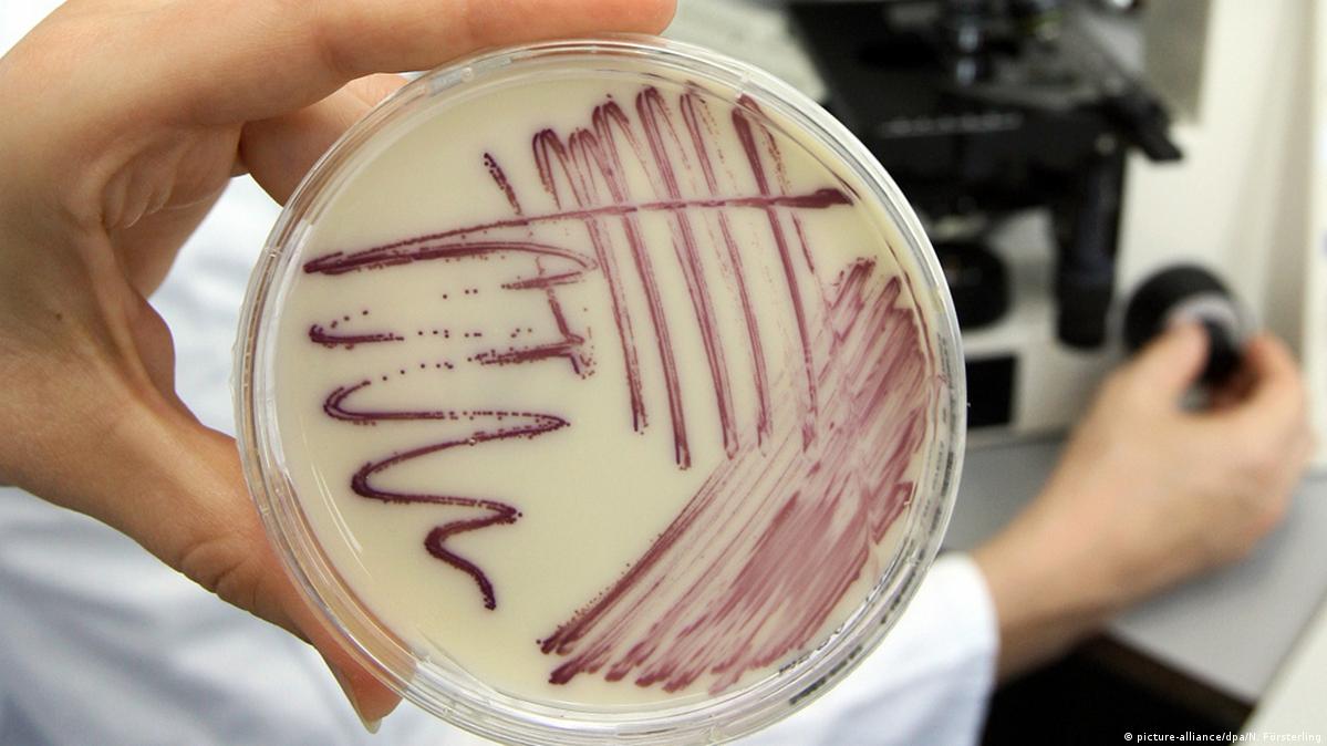 Durchbruch im Kampf gegen resistente Erreger? – DW – 27.07.2016