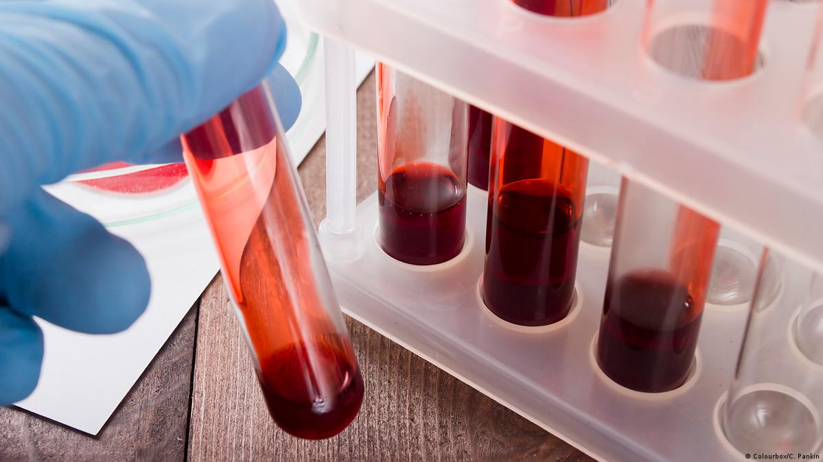 UK opens inquiry into tainted-blood scandal – DW – 05/01/2019