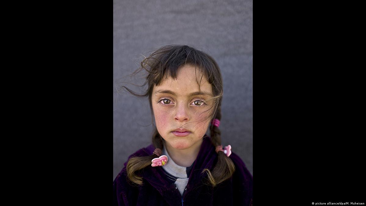 Suffering children: 'UNICEF Photo of the Year Award 2017' – DW – 12/21/2017