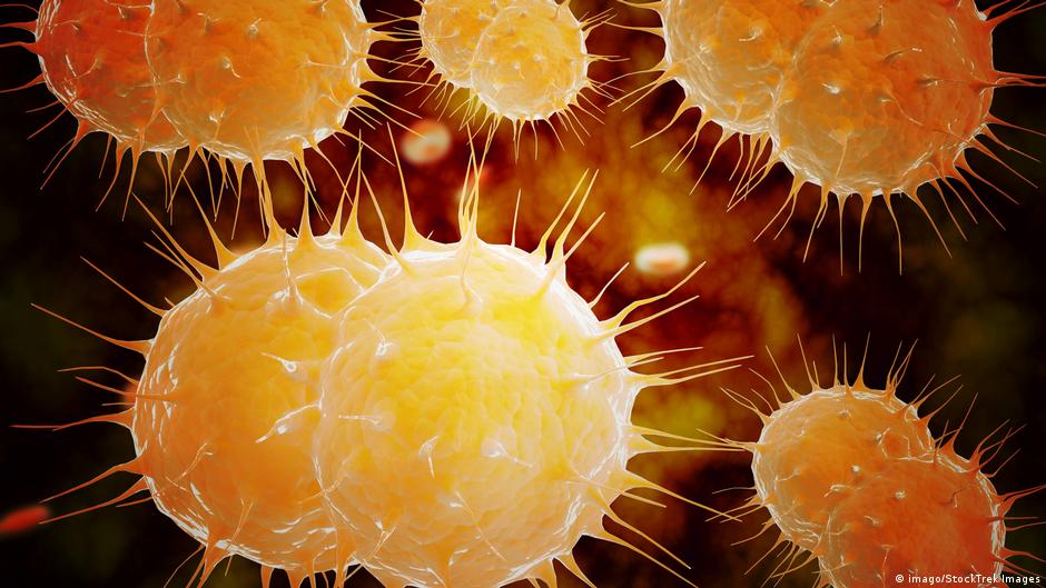 Kifahamu Kisonono sugu ama "Super Gonorrhea" – DW – 31.01.2023