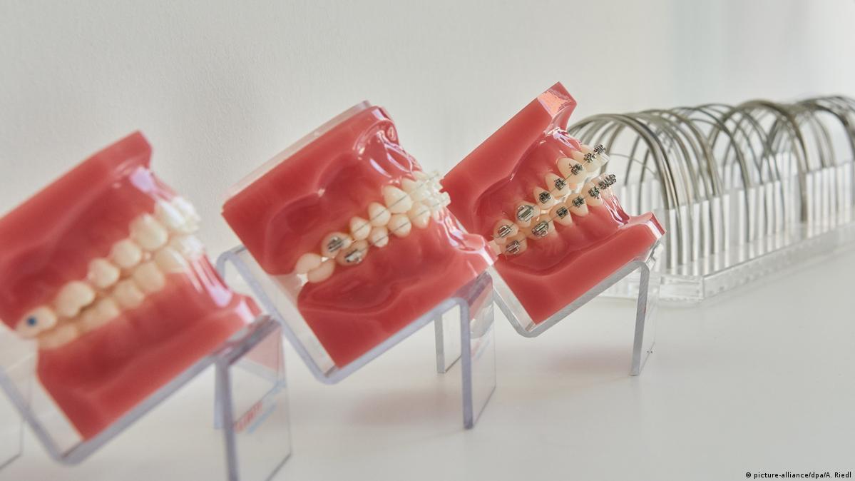 German ministry questions benefits of braces – DW – 01/03/2019