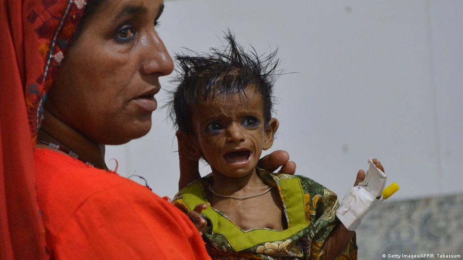 Pakistan struggling to eradicate child malnutrition – DW – 06/21/2019