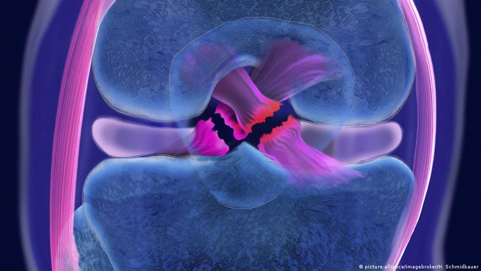 When our knees fail us – DW – 05/06/2022