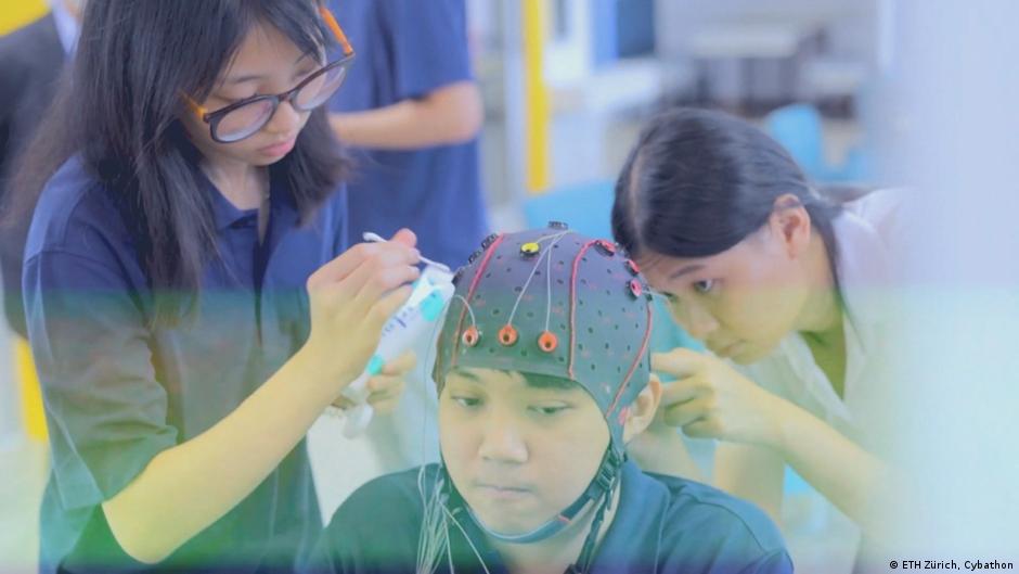 Smart Prosthetics – DW – 02/04/2021