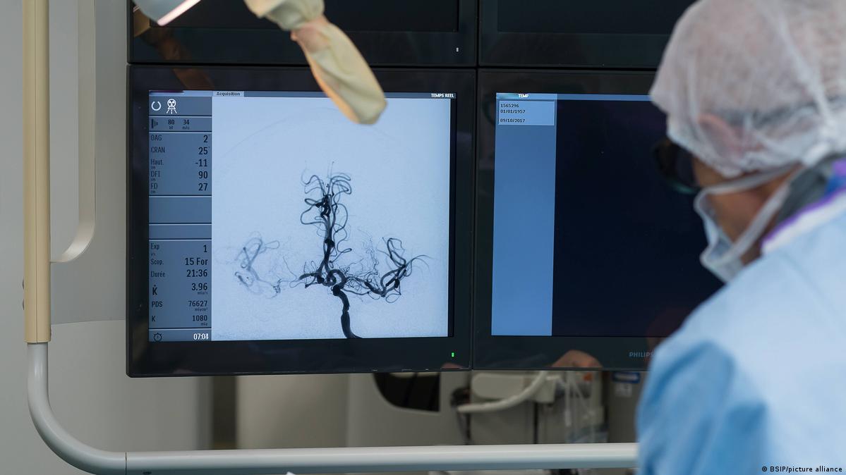 Waspada Stroke atau Serangan Otak Mendadak di Usia Muda – DW – 29.10.2021