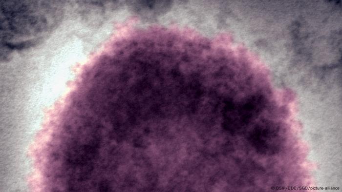 Monkeypox virus mutations ′challenging′ what we know | Science | In ...
