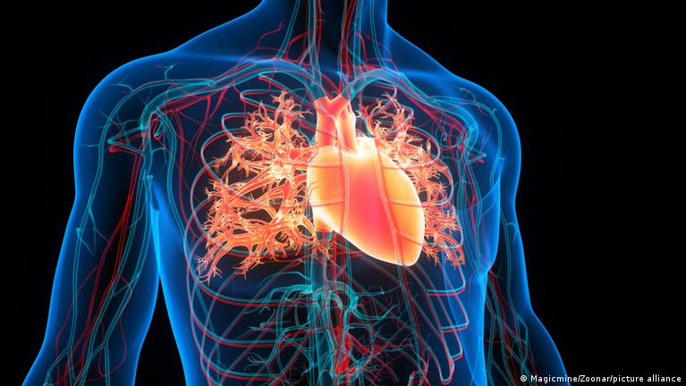 Logran primer trasplante con corazón "muerto" por 20 minutos – DW – 16 ...