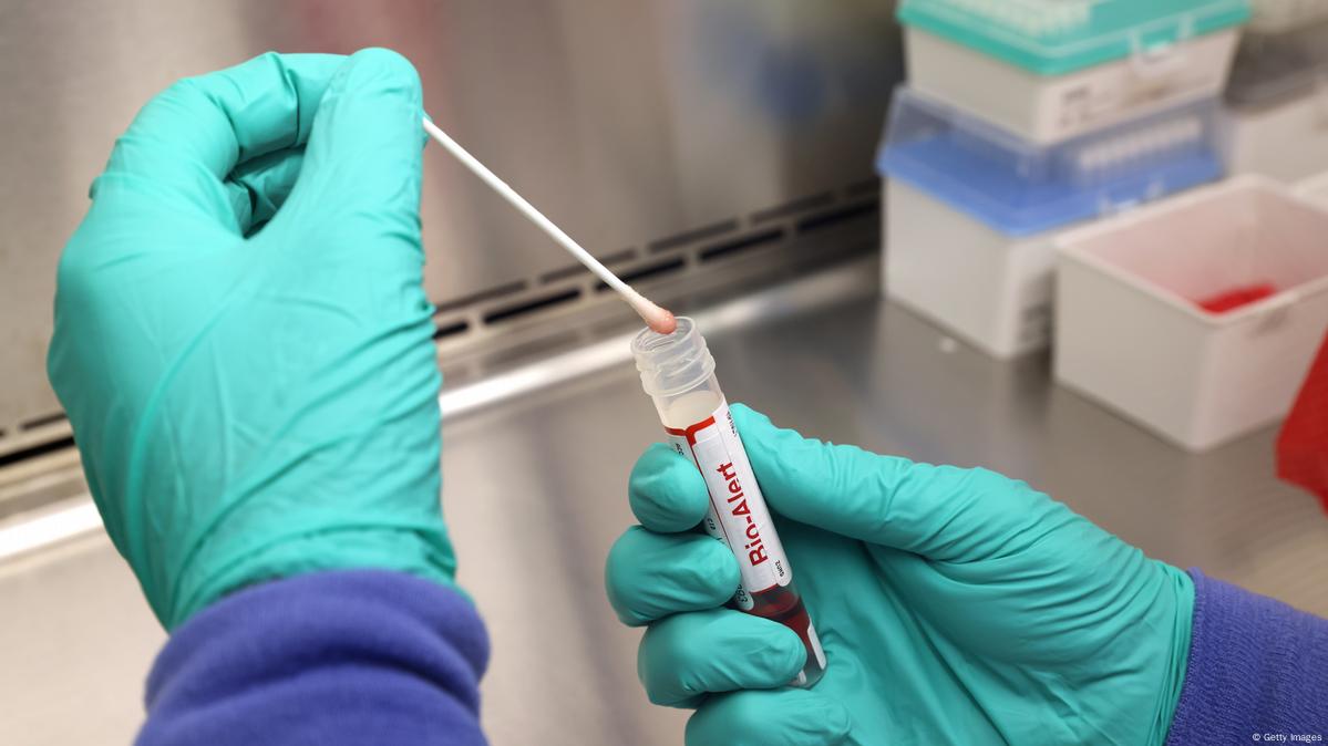 Nueva York Declara Estado De Emergencia Por Viruela Del Mono Dw 30