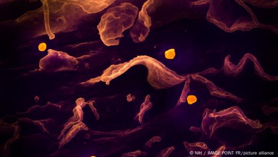 Nipah virus: A recurring, deadly threat in India – DW – 09/16/2024 Nipah virus: A recurring, deadly threat in India – DW – 09/16/2024