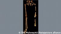Borneo skeleton thought to be oldest example of amputation