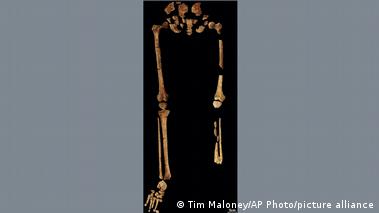Borneo skeleton thought to be oldest example of amputation