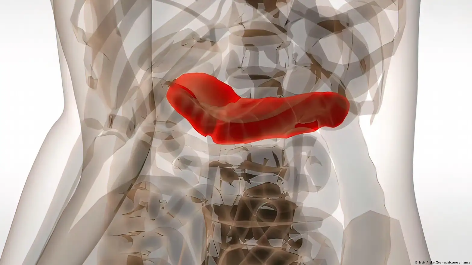 Cancer De Pancreas Real Trusted Pancreatic Cancer Specialists