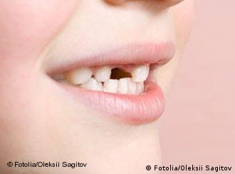 Inside Europe: The financial crisis and Greek teeth – DW – 04/20/2018