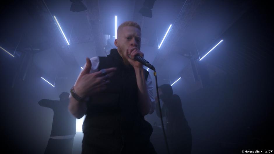 Afro-German artist Albi X fights stigma with rap music – DW – 06/12/2023