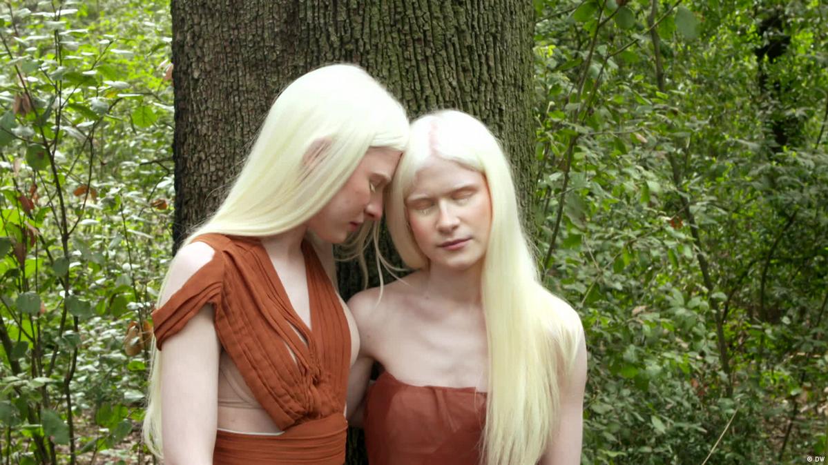 Ist Body Positivity schon wieder out? – DW – 16.06.2023