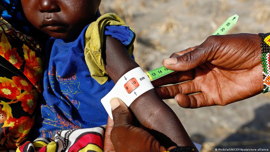 A Cry for Help: Child Malnutrition and Humanitarian Crisis in Mali ...
