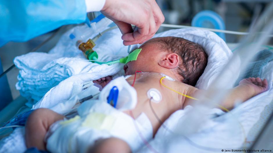 The long-term consequences of preterm birth revealed – DW – 01/11/2025