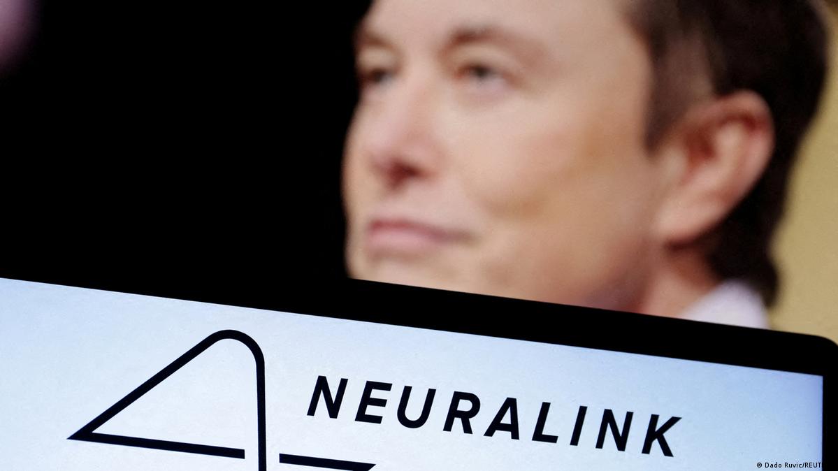 Musk's Neuralink implants brain chip in first human – DW – 01/30/2024