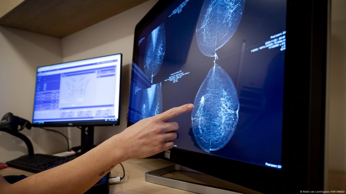 New AI method improves early breast cancer detection – DW – 01/22/2025 New AI method improves early breast cancer detection – DW – 01/22/2025