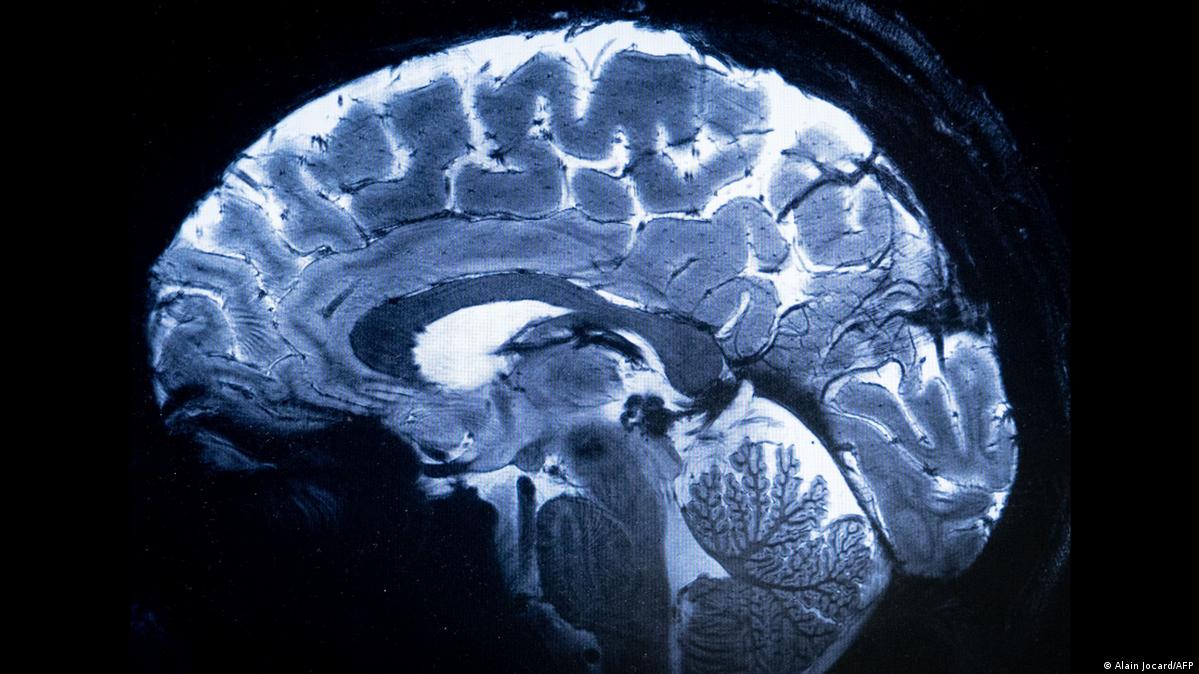 Estudio revela que el cerebro humano es cada vez más grande