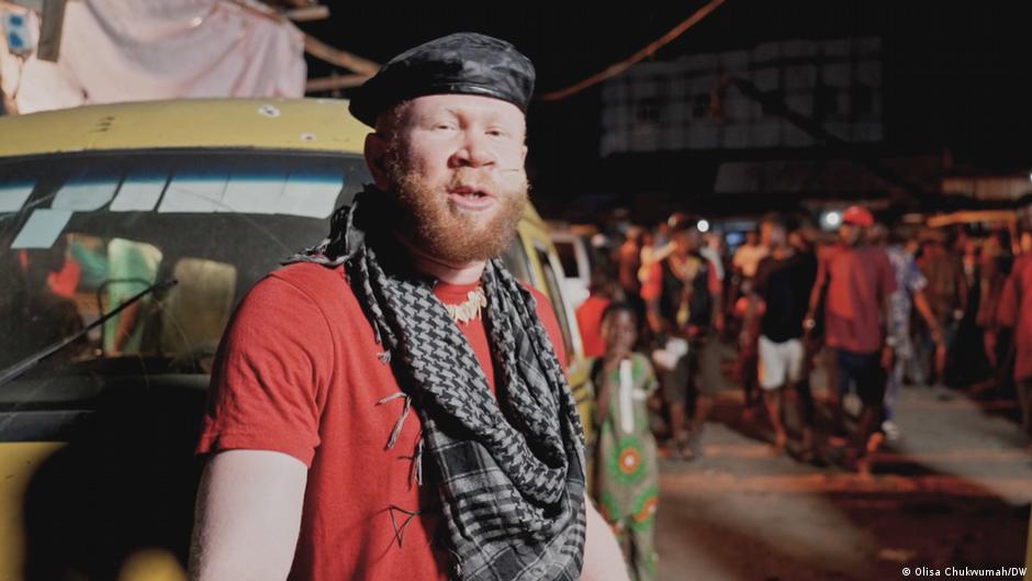 Actor with albinism breaks barriers in Nigeria's Nollywood – DW – 05/30 ...