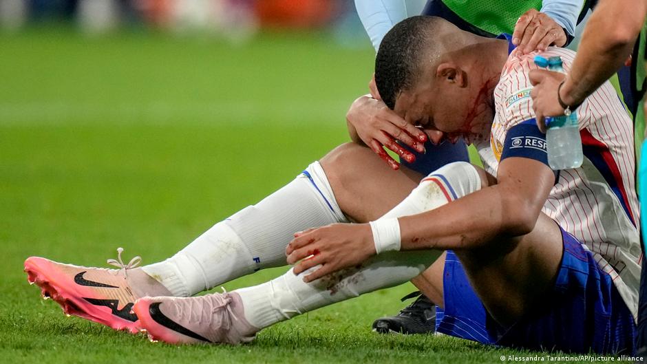 Euro 2024 : la France souffre mais bat l'Autriche – DW – 18/06/2024