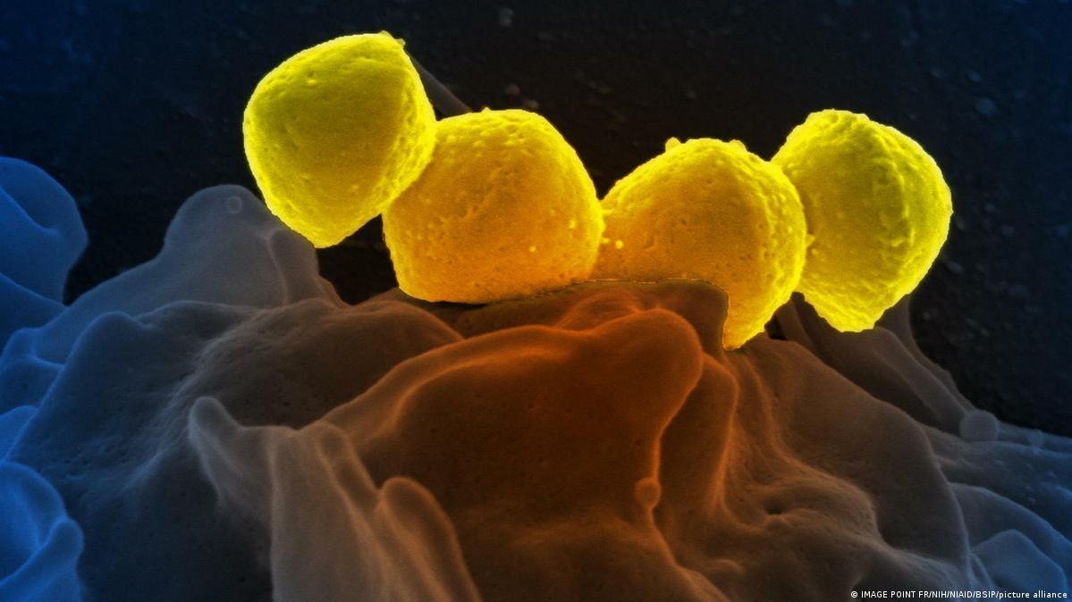 Japan: Deadly flesh-eating bacteria infections on the rise