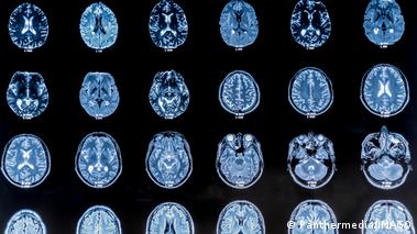 Naš mozak se menja četiri puta – DW – 1. 12. 2025.