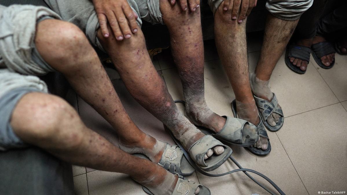 Rights groups accuse Israel of Palestinian detainee abuse – DW – 08/09/2024