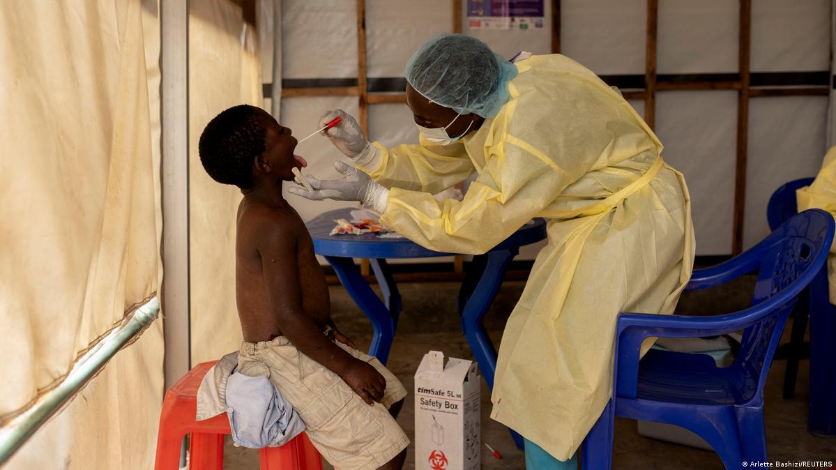 Suécia registra 1º caso de mpox fora da África em novo surto