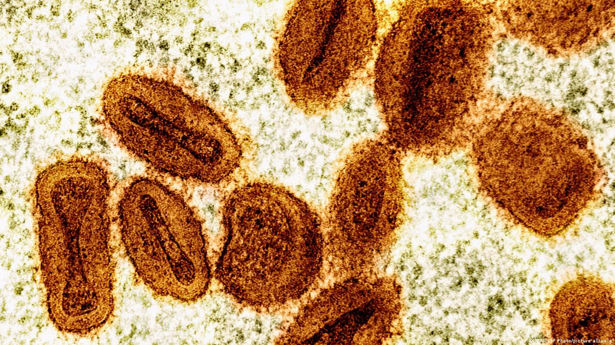 Mpox: Angola com risco elevado devido a fronteira com RDC