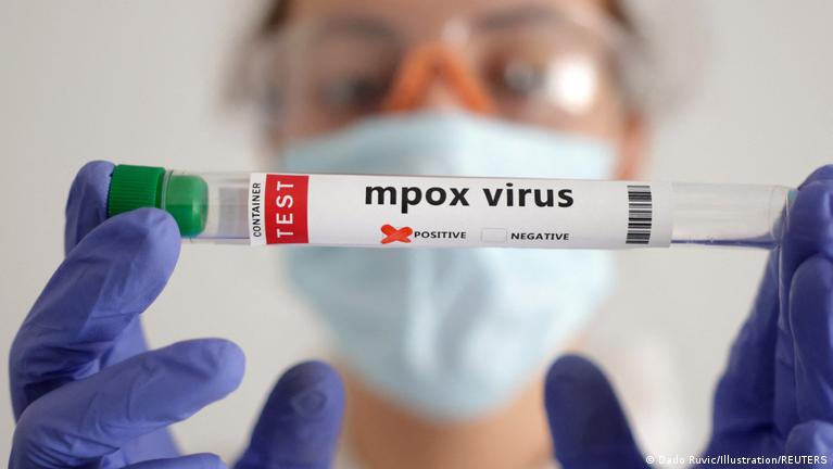 Tailandia registra primer caso de nueva variante de la mpox – DW – 22 ...