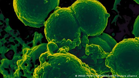 8 most dangerous antibiotic-resistant bacteria in the world – DW – 11 ...