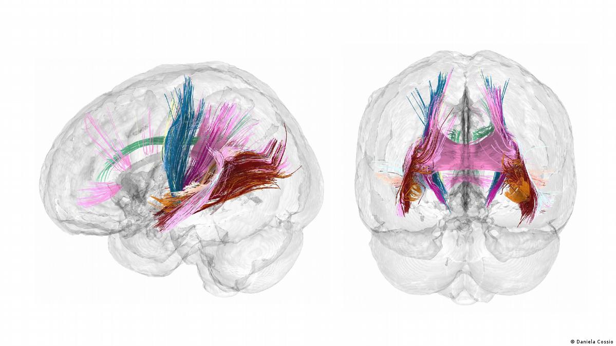 Pregnancy completely rewires mothers' brains — study – DW – 09/18/2024