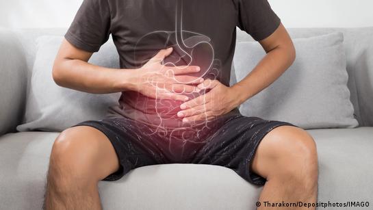 Apendicectomía podría ayudar a personas con colitis ulcerosa – DW – 16 ...