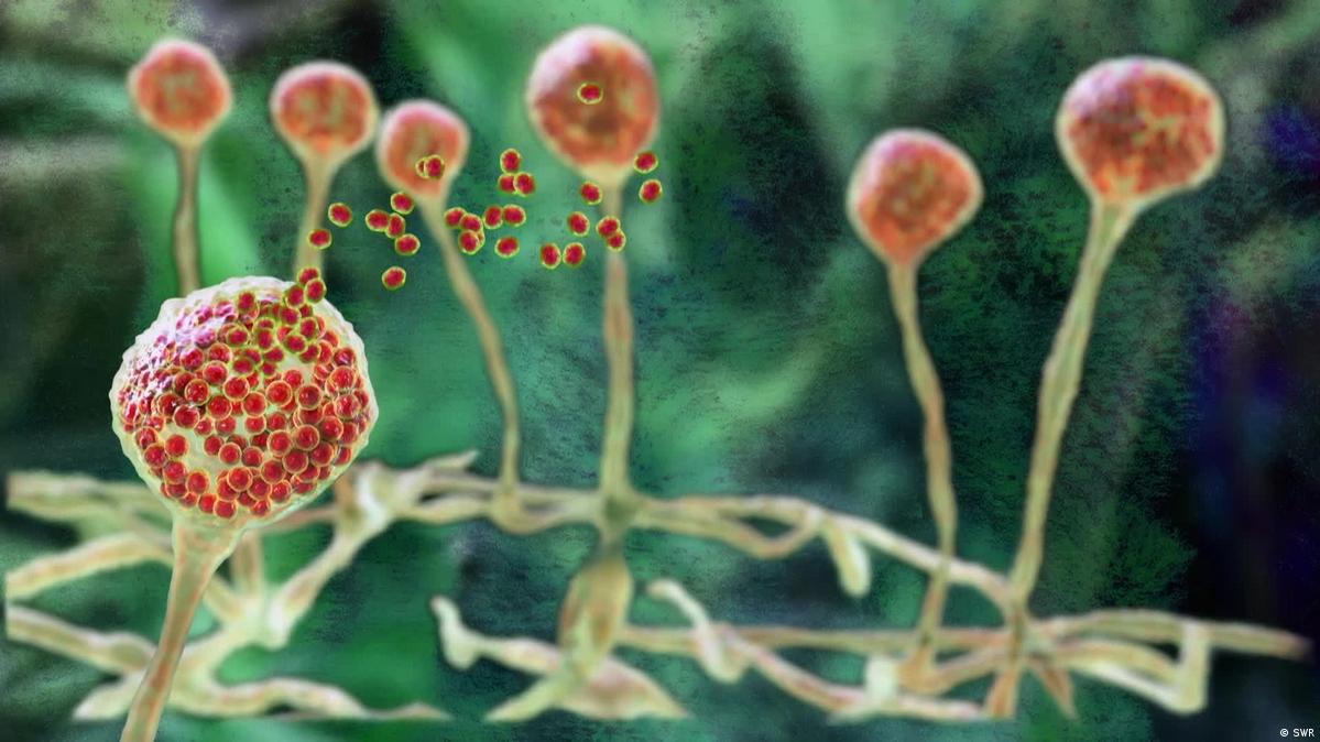 Infecciones fúngicas invasivas - La nueva amenaza